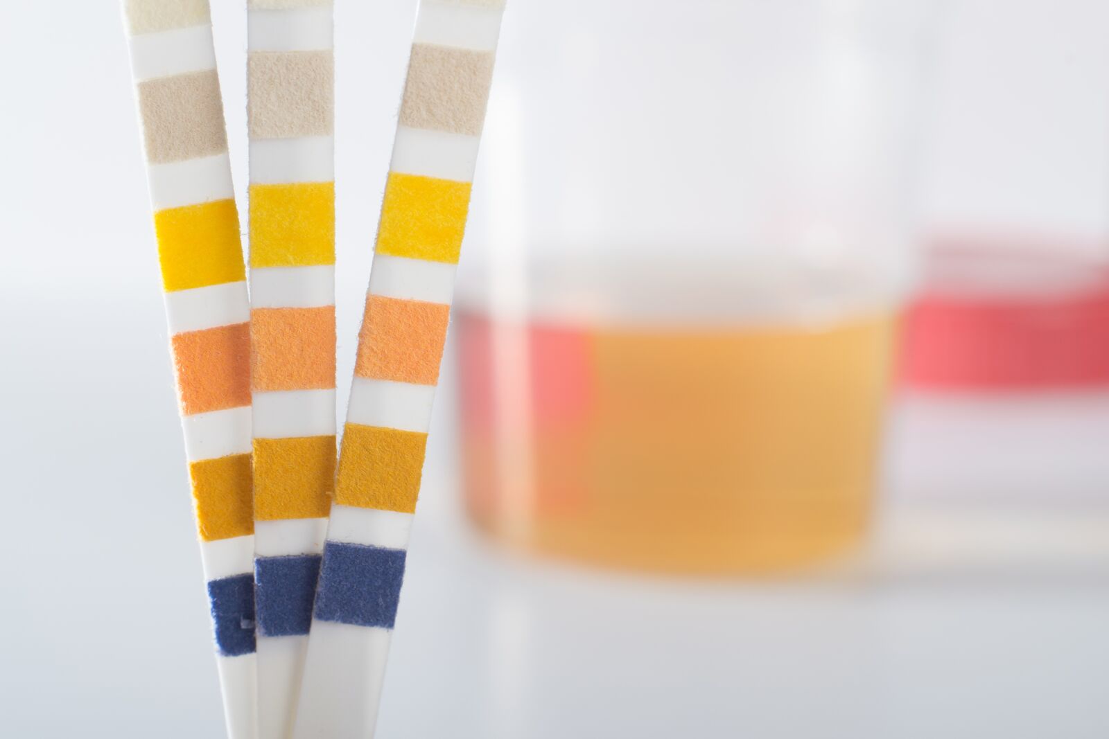 Post-Market Surveillance under IVDR: A Guide for IVD Professionals ...